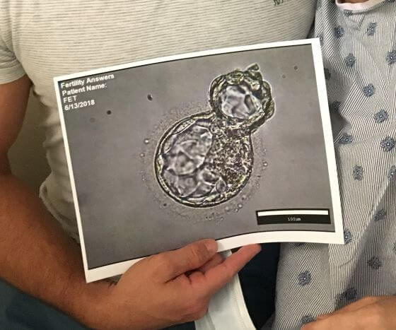 IVF Lab Q&A: All Your Embryo Questions Answered - Fertility Answers